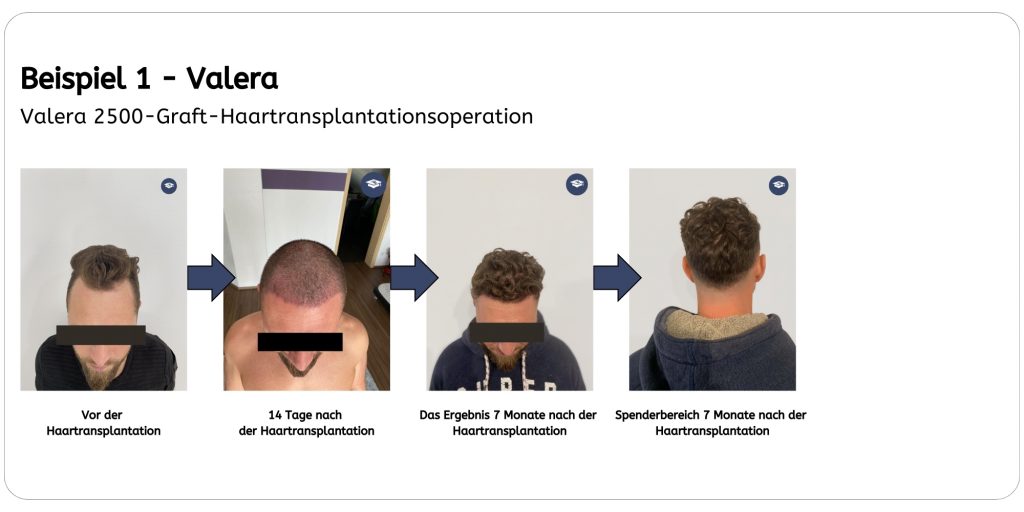 Vorher-Nacher Bilder & Erfahrungsberichte